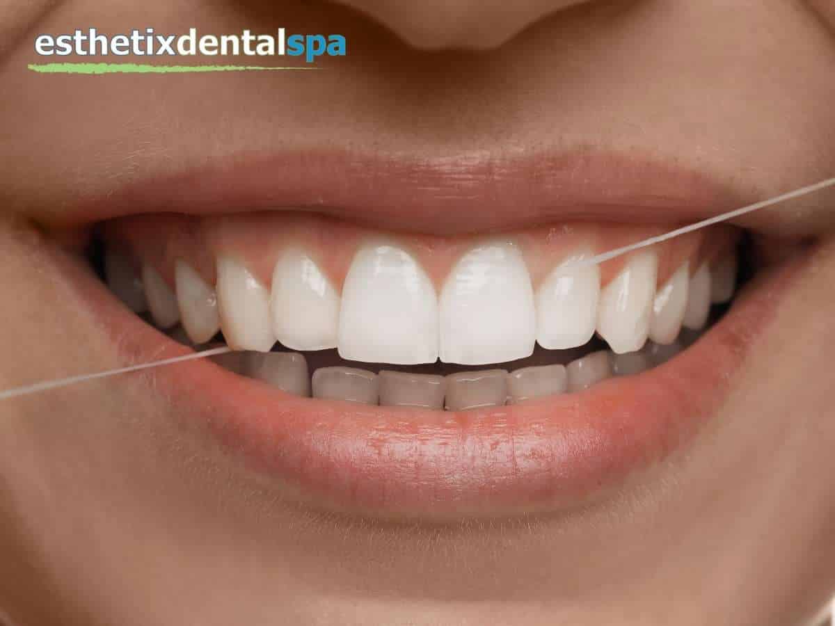 How Do I Keep My Invisalign Trays From Turning Yellow?