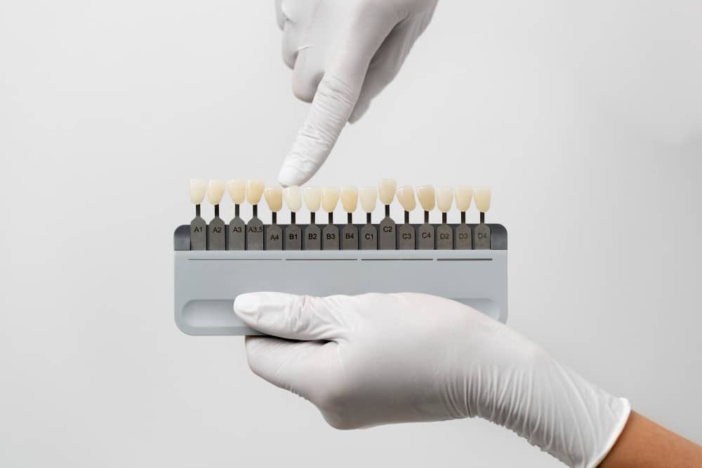 5-Star Rated Dental Crowns And Veneers Near Harlem, NY