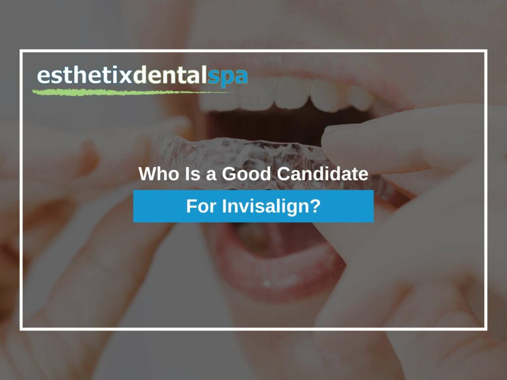 Who Is a Good Candidate For Invisalign?